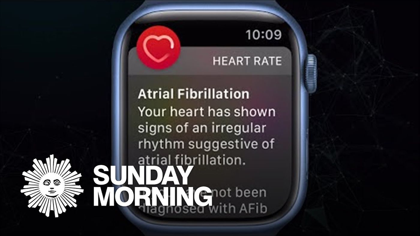 Apple Watch : Apple vante les mérites de sa smartwatch sur CBS ...