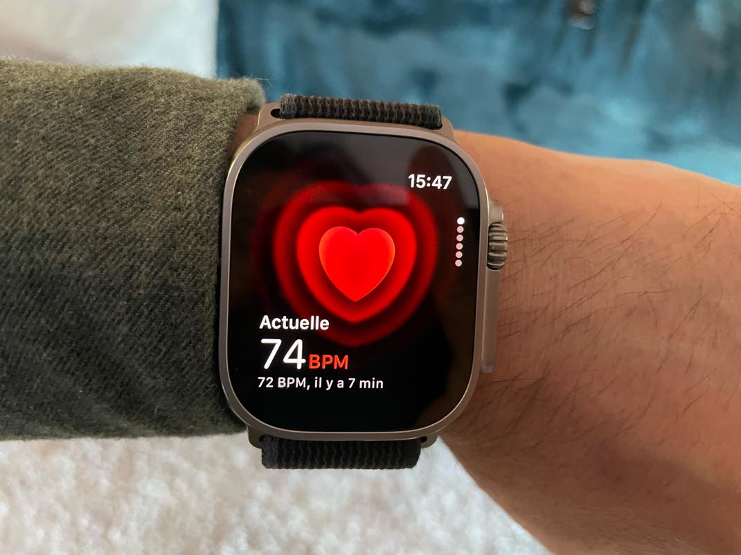 Justice : Apple remporte une victoire importante contre AliveCor ...